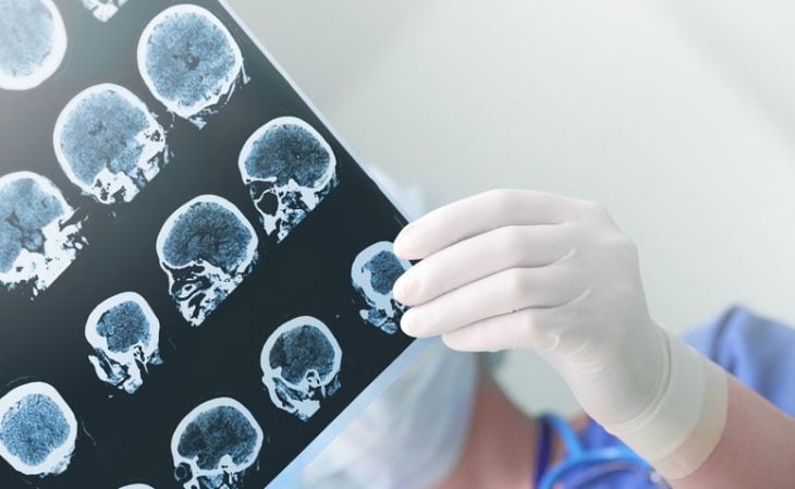 8 razões que explicam a vontade de fazer xixi toda hora