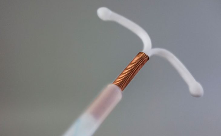 DIU: é seguro? Como colocar? Qual o preço? Ginecologista responde!