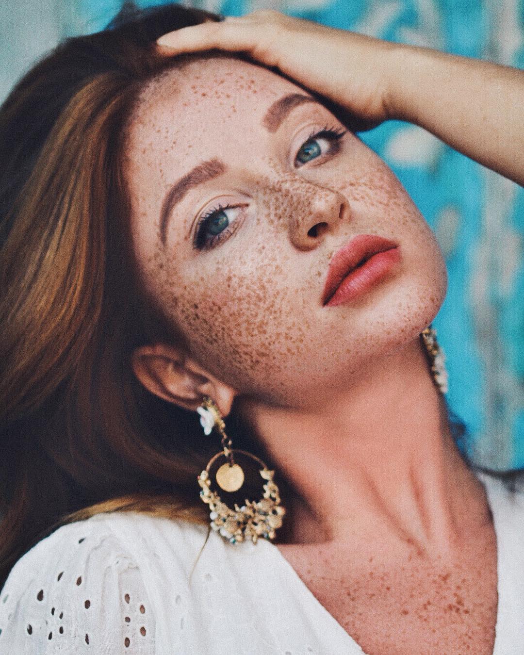 Sardas: como prevenir, eliminar ou valorizá-las ainda mais