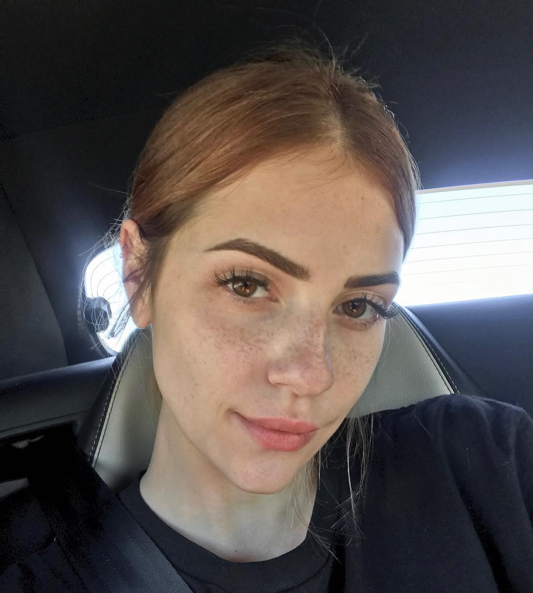 Sardas: como prevenir, eliminar ou valorizá-las ainda mais