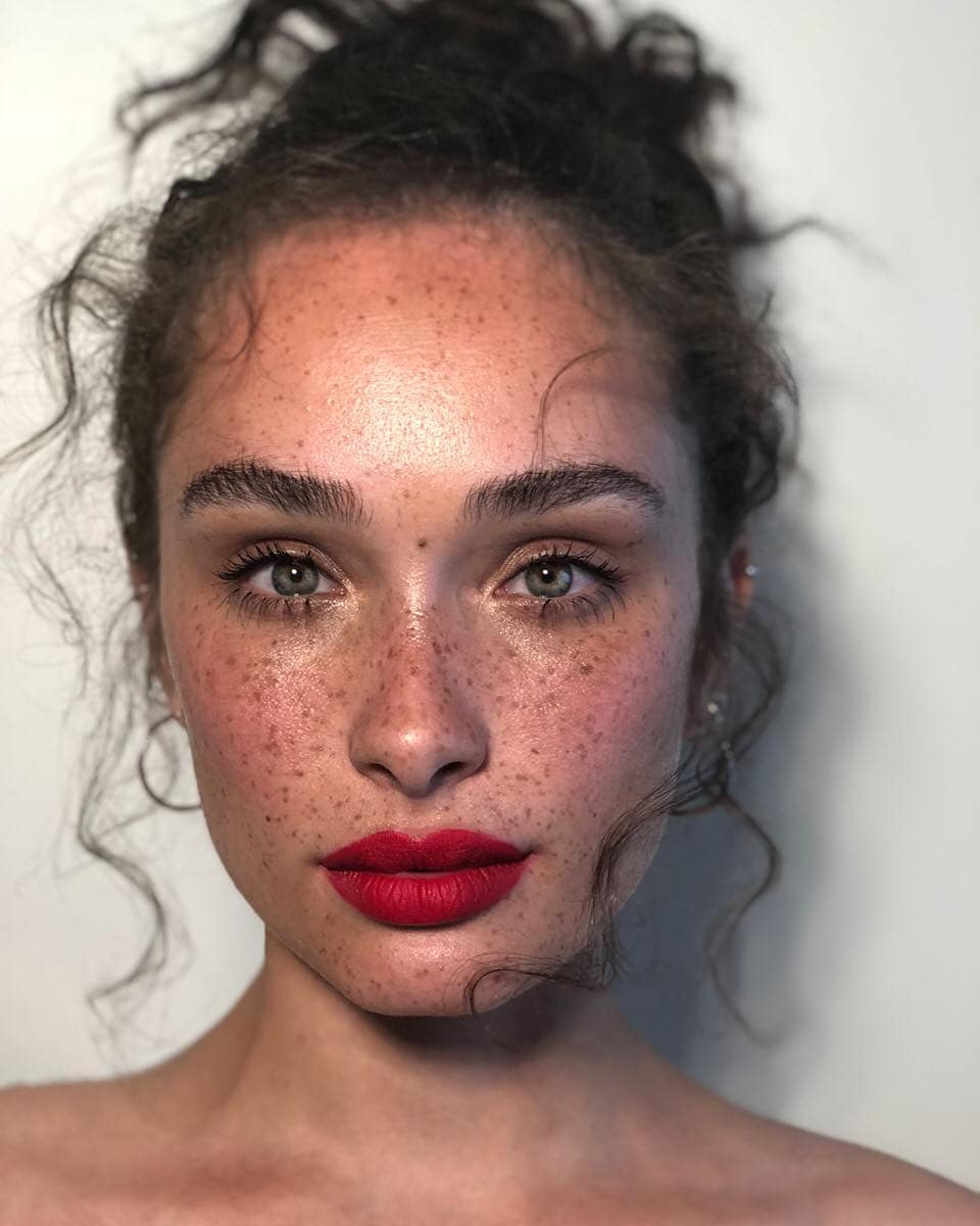 Sardas: como prevenir, eliminar ou valorizá-las ainda mais