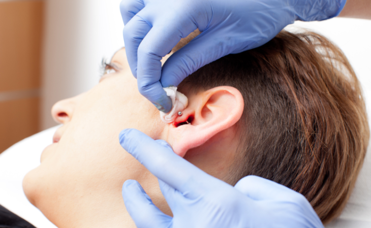 Piercing inflamado: causas, como identificar, cuidar e higienizar