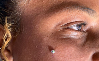 Piercing microdermal: onde colocar, cuidados e fotos