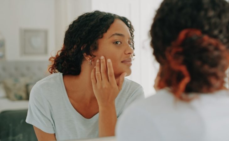 Espinha inflamada: o que é e como cuidar dela